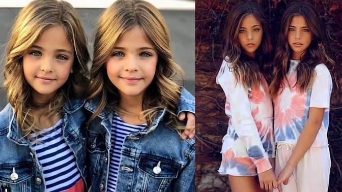 They were named the most beautiful twins in the world at seven. This is ...